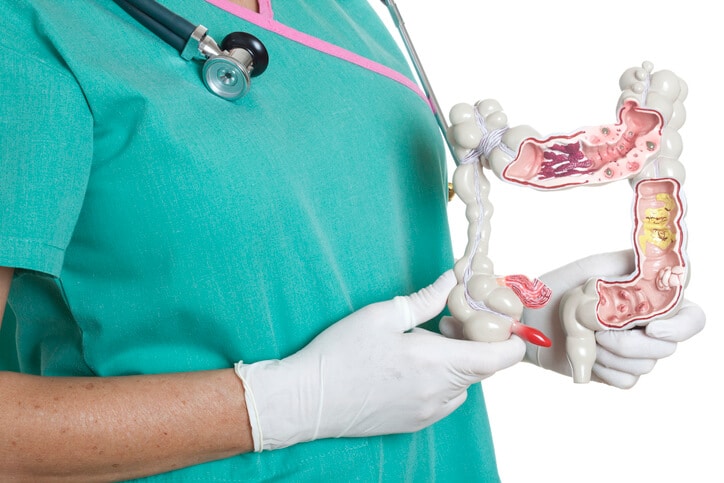 Colectomía Abdominal Total: ¿Ofrece mejores resultados a largo plazo en ...